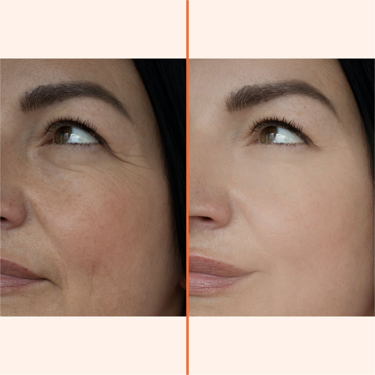 3D Filler | VLCC