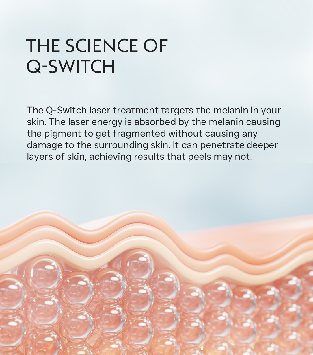 Q Switch Laser Treatment for Pigmentation at Best Price | VLCC