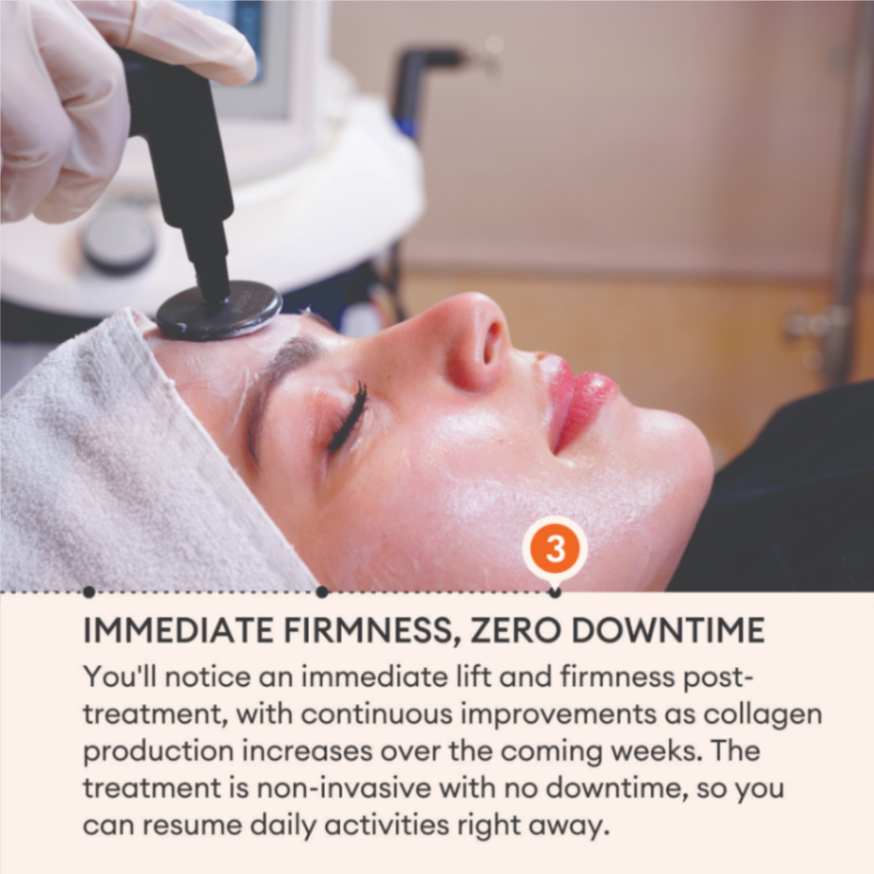 Advanced Skin Tightening and Rejuvenation with Indiba Face Anti Ageing ...