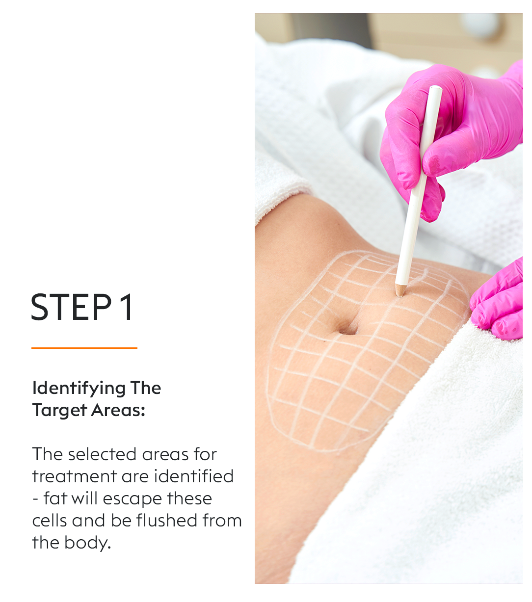 Lipo Laser Slimming Treatment Cost for Non Surgical Fat Loss | VLCC