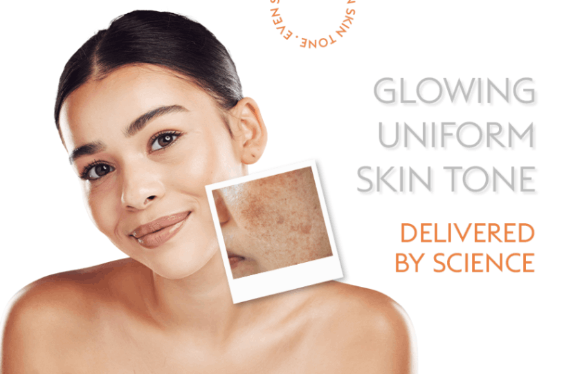 Best Facial Pigmentation Treatment for Dullness | VLCC